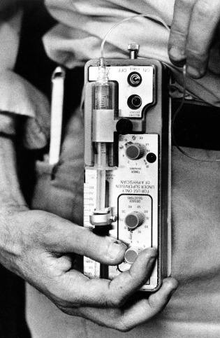 One of the first insulin pumps! | The Savvy Diabetic